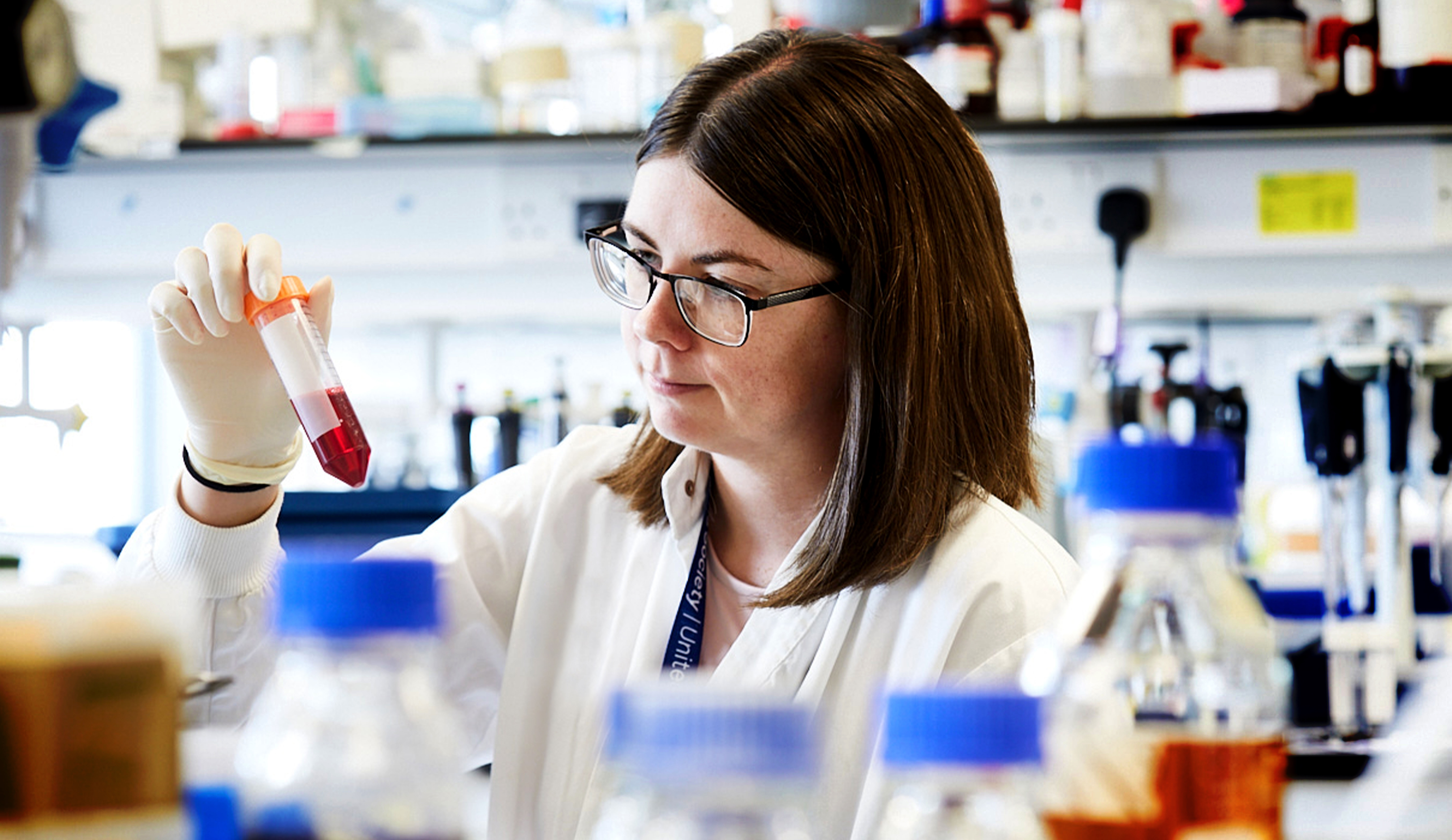 2024: Looking back at an exciting year for research at Alzheimer’s ...